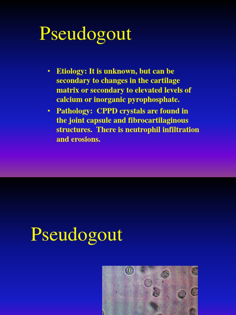 Dr. Veny Mandang - Pseudogout | PDF | Diseases And Disorders | Clinical ...