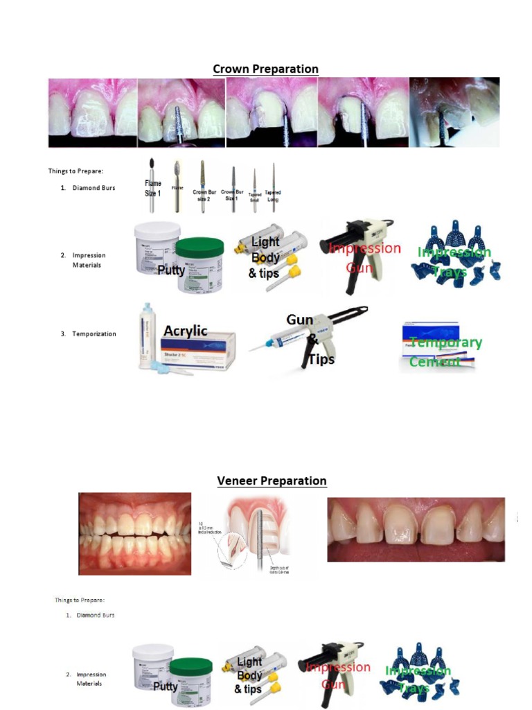 Crown Preparation: Things To Prepare: 1. Diamond Burs | PDF