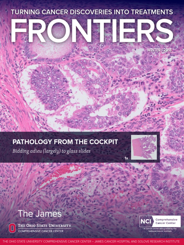 OSU Frontiers Magazine - Winter 2018 - DP Article | PDF | Pathology ...
