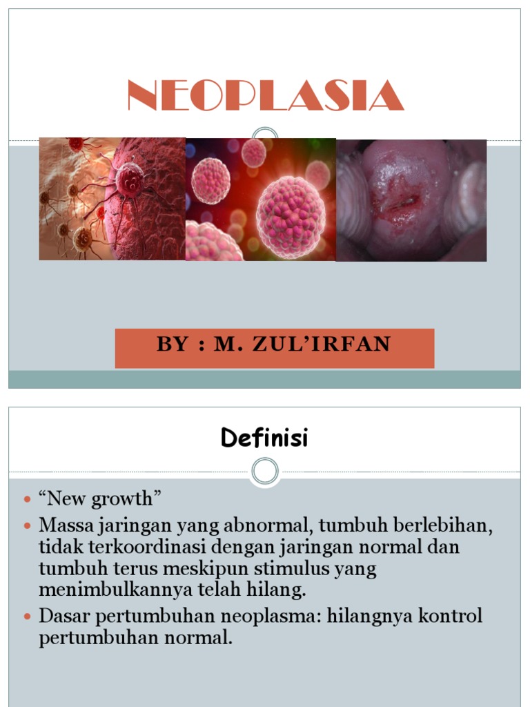 Konsep Neoplasma | PDF | Pengembangan Diri