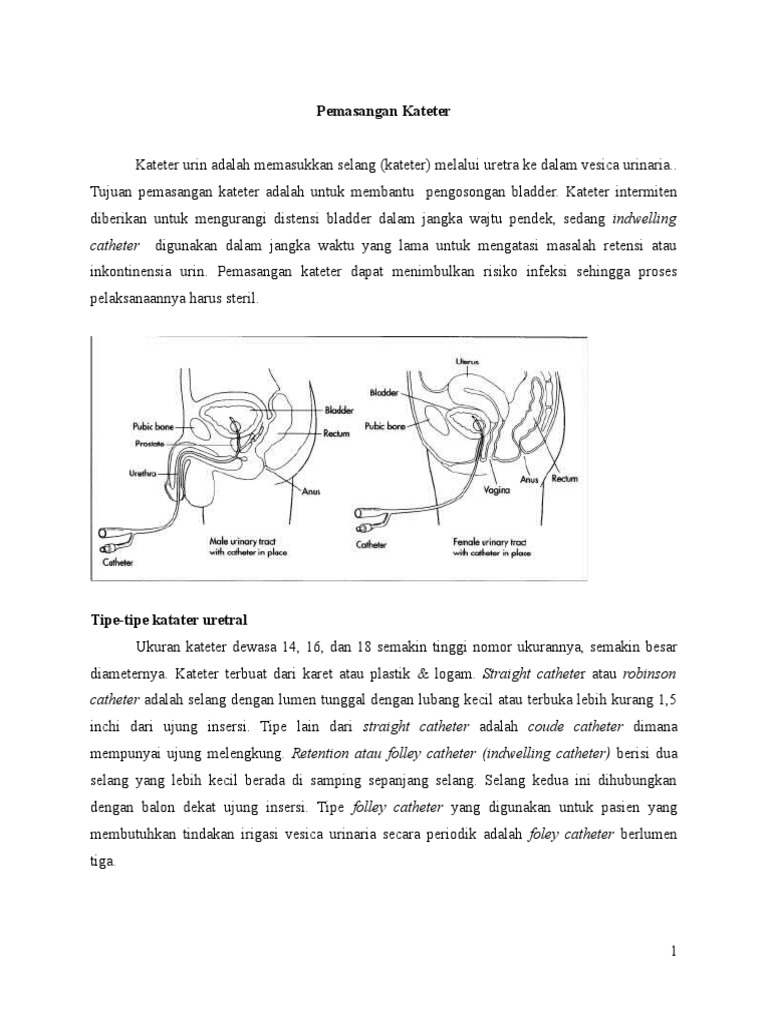 Documents - Tips Sop-Kateter | PDF