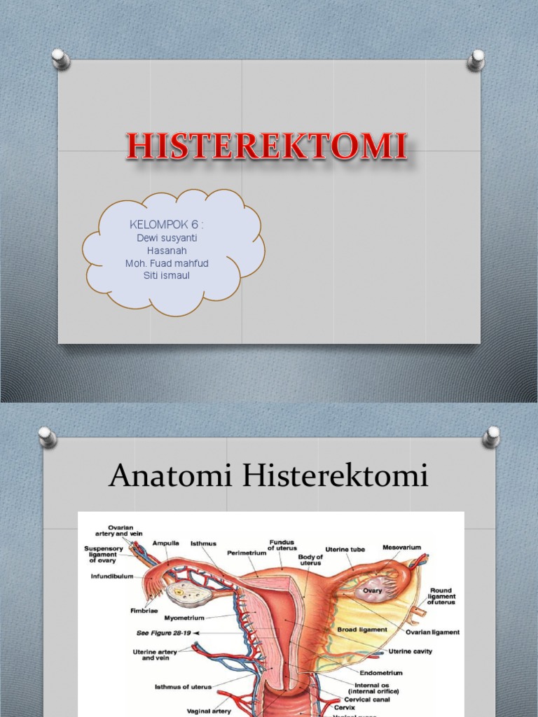 HISTEREKTOMI | PDF