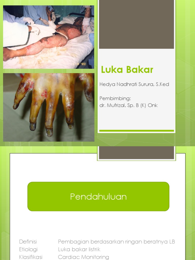 Pasien Combutio Luka Bakar Listrik-Resusitasi Luka Bakar | PDF