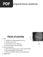 HINTS Exam for Vestibular Assessment | PDF | Vertigo | Vestibular System