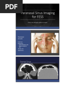 The Preoperative Sinus CT: Avoiding A "Close" Call With Surgical ...