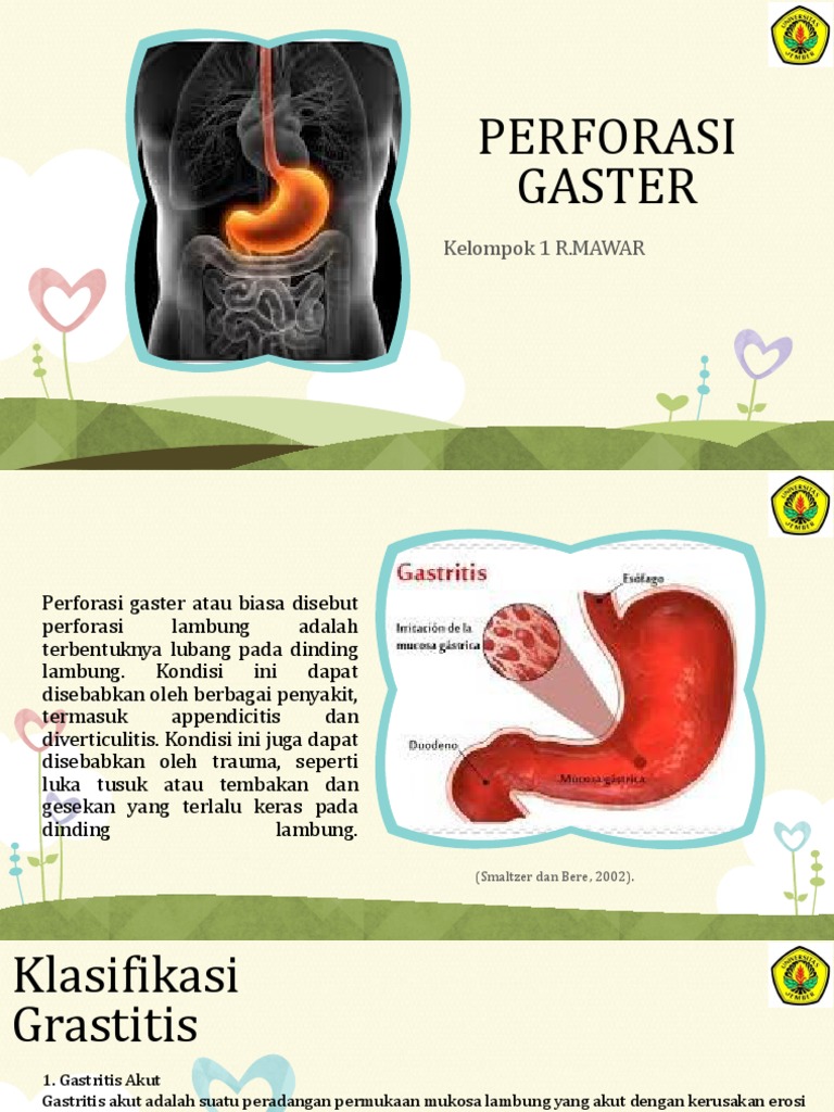 Perforasi Gaster | PDF