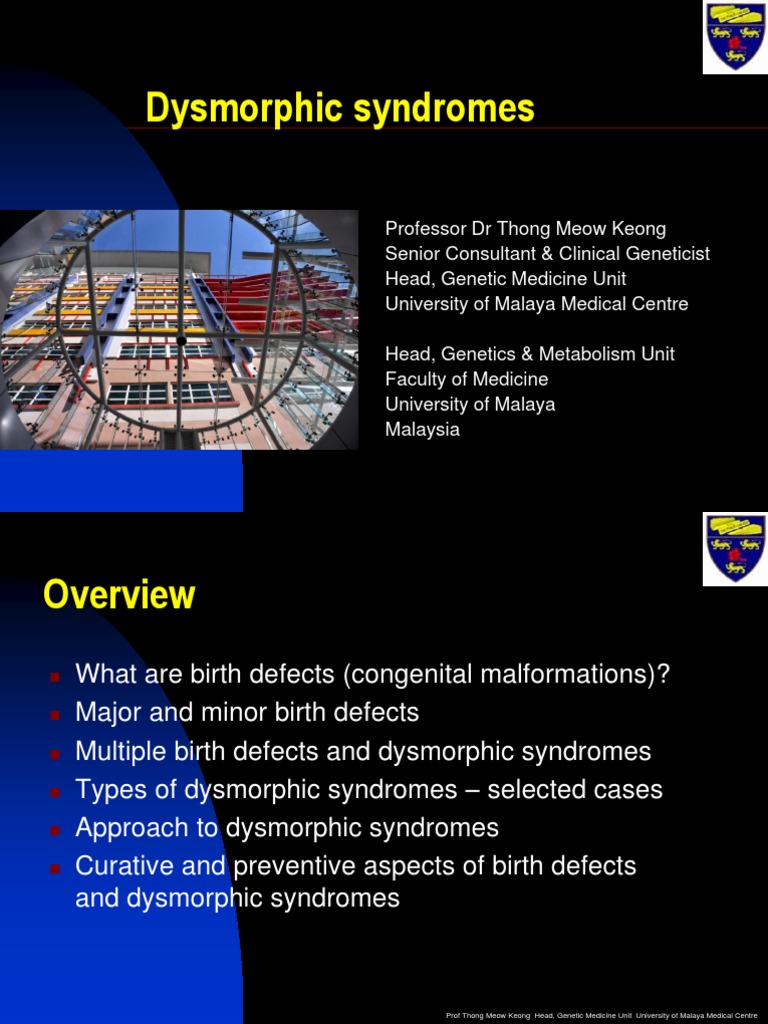 Dysmorphic Syndromes - Thong Meow Keong | PDF | Medical Genetics ...