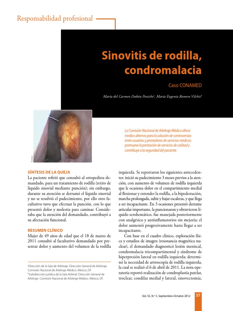 Sinovitis de rodilla.pdf | Osteoartritis | Artritis Reumatoide