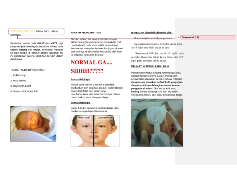 Ikterik Pdf