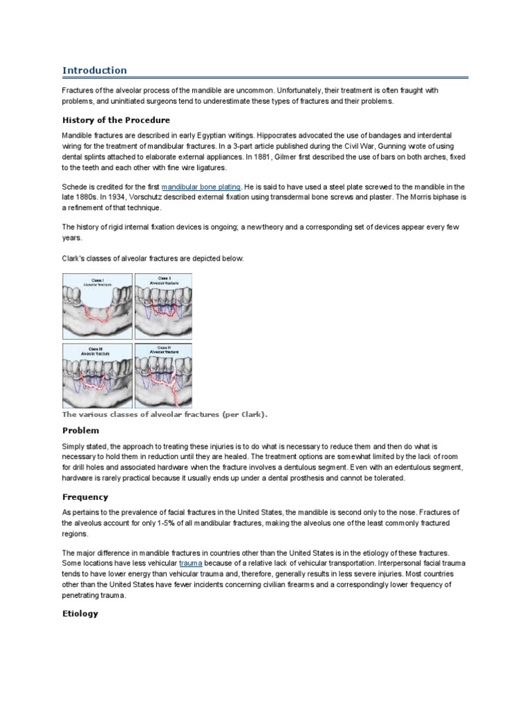 Alveolar Process Fractures: Overview & Treatment | PDF | Surgery ...