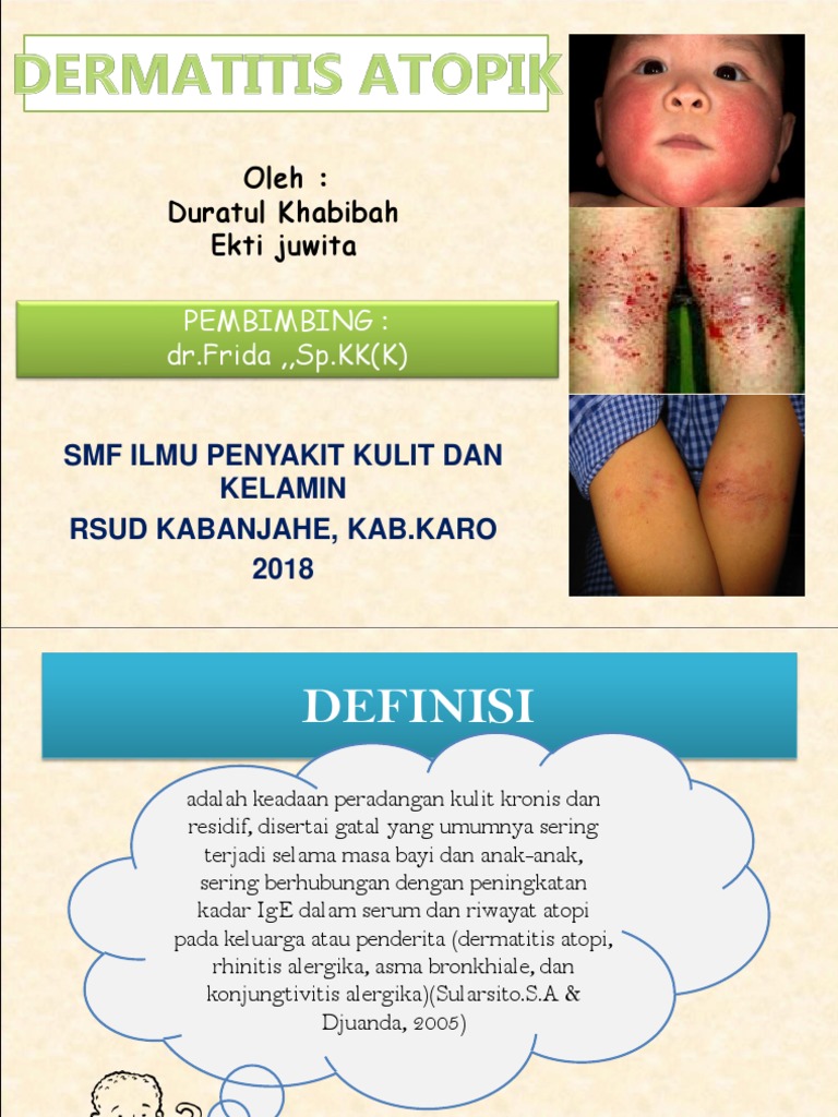 Dermatitis Atopik | PDF