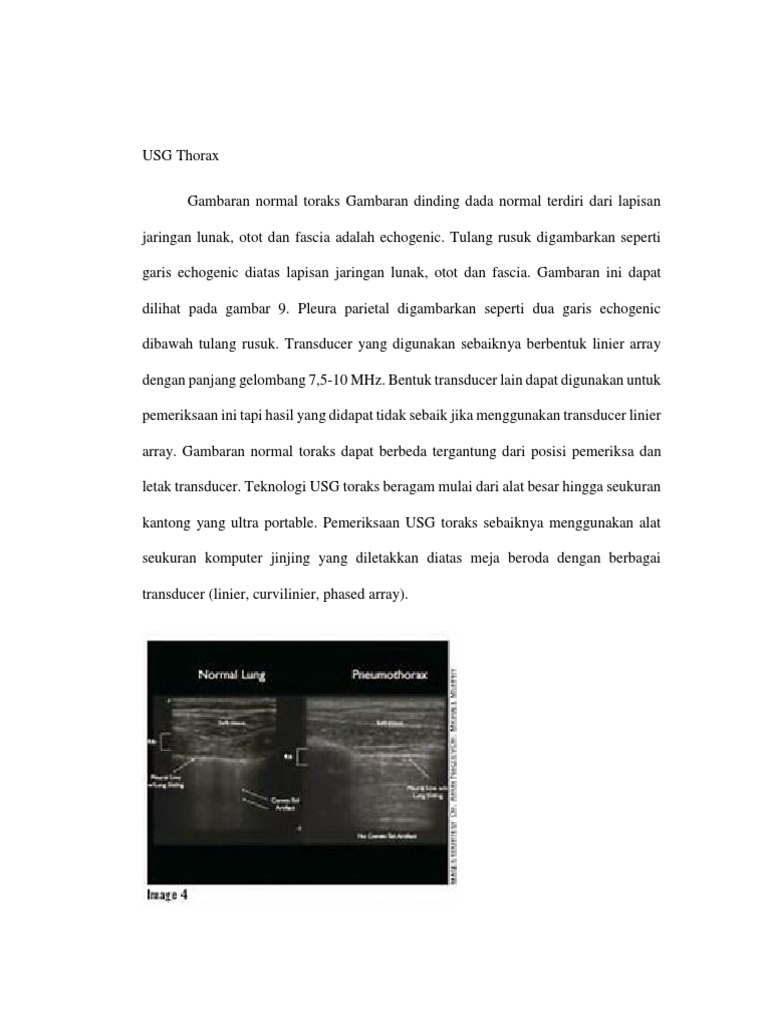 USG Thorax | PDF