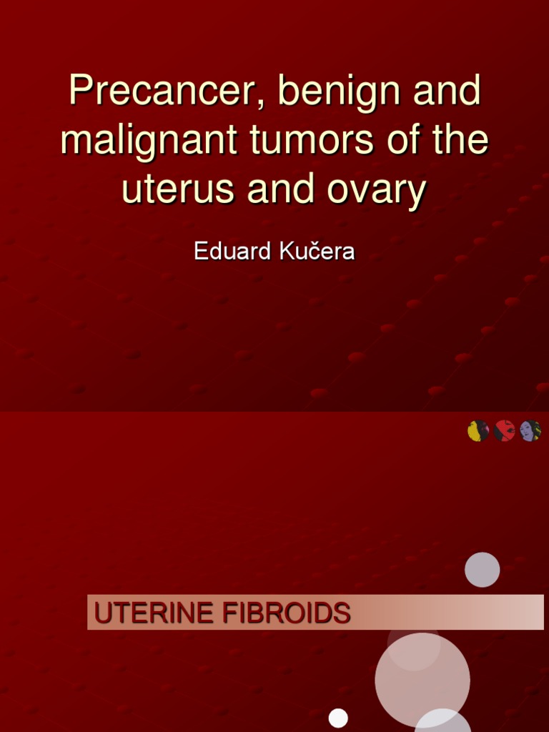 Tumors of Uterus and Ovary | PDF | Ovarian Cancer | Neoplasms