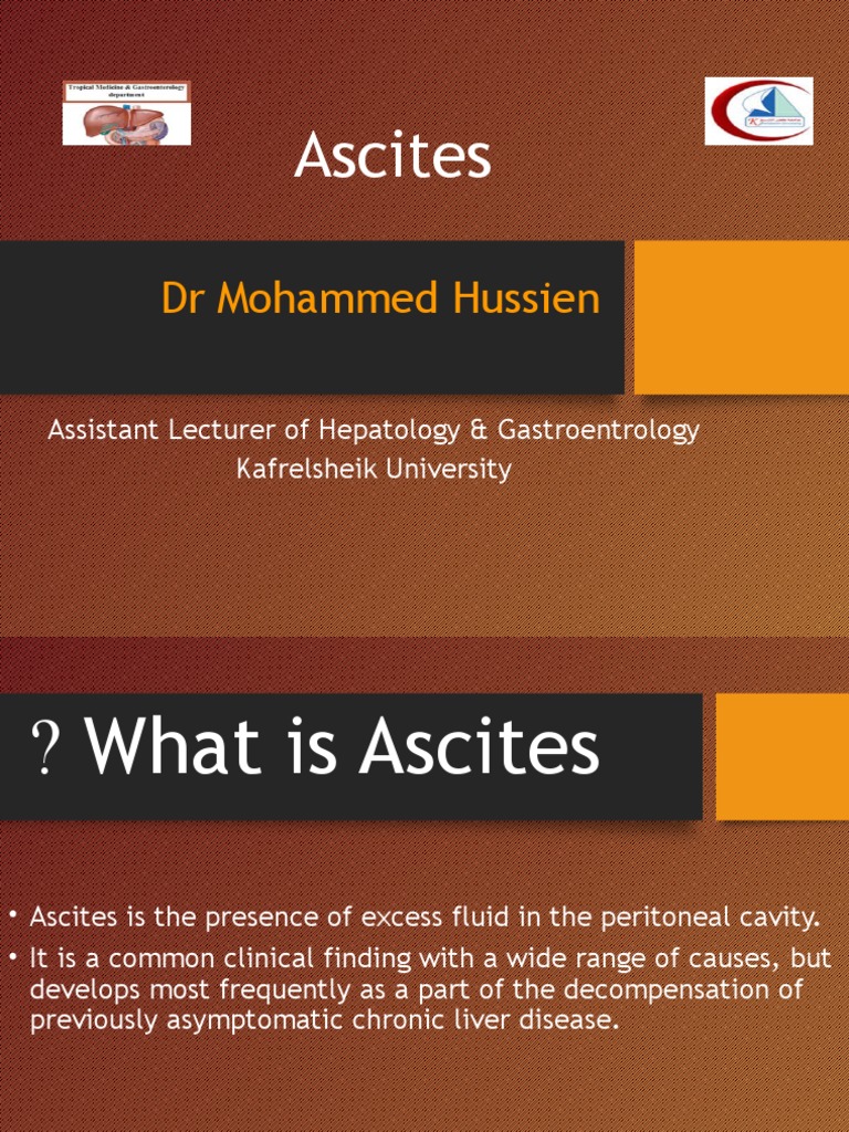 An In-Depth Review of Ascites: Causes, Pathogenesis, Clinical ...