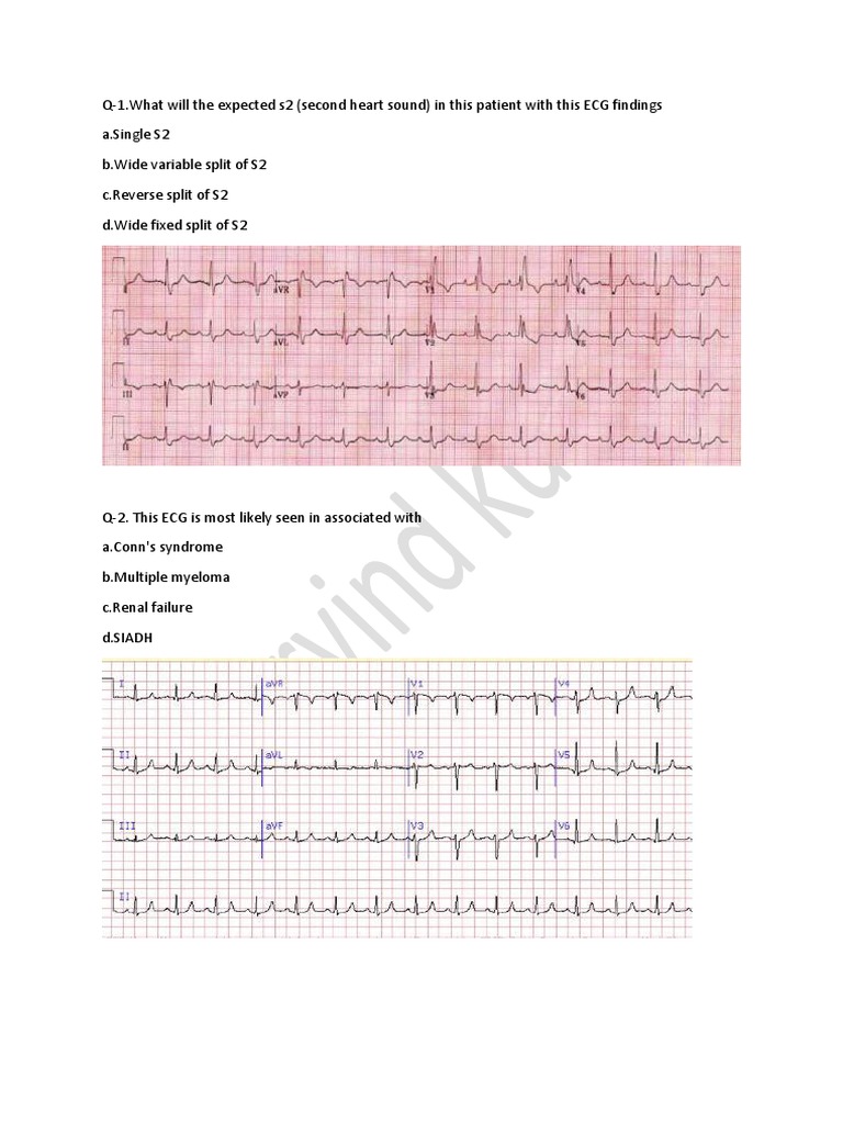 ECG Practice - Docx1408972052 | PDF | Electrocardiography | Cardiac ...