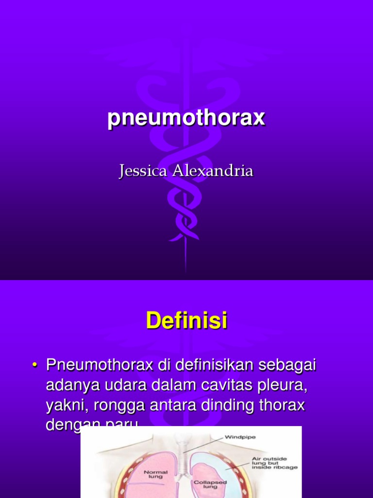 PNEUMOTHORAX PPT Paru | PDF