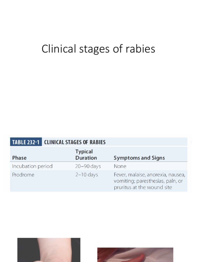 Rabies Clinical Stages and PEP Guidelines | PDF