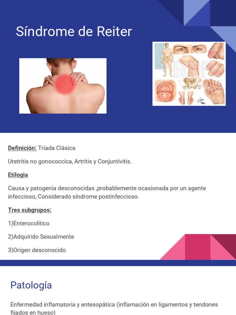 Síndrome de Reiter Presentacion | PDF | Piel | Inflamación