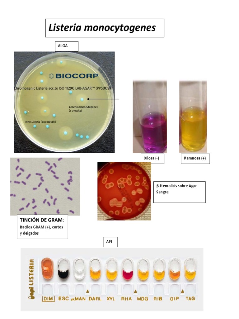 Listeria monocytogenes: Cultivo y Pruebas | PDF