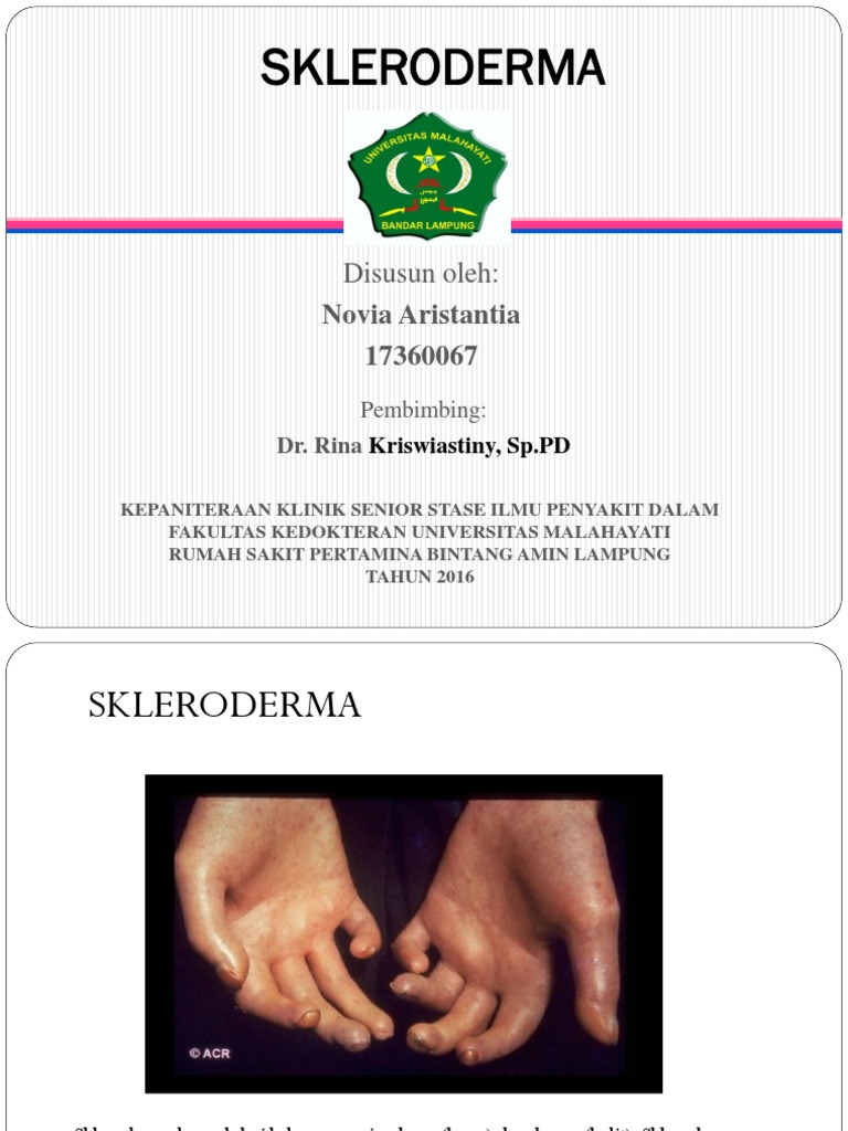 Panduan Skleroderma untuk Dokter | PDF | Sains & Matematika