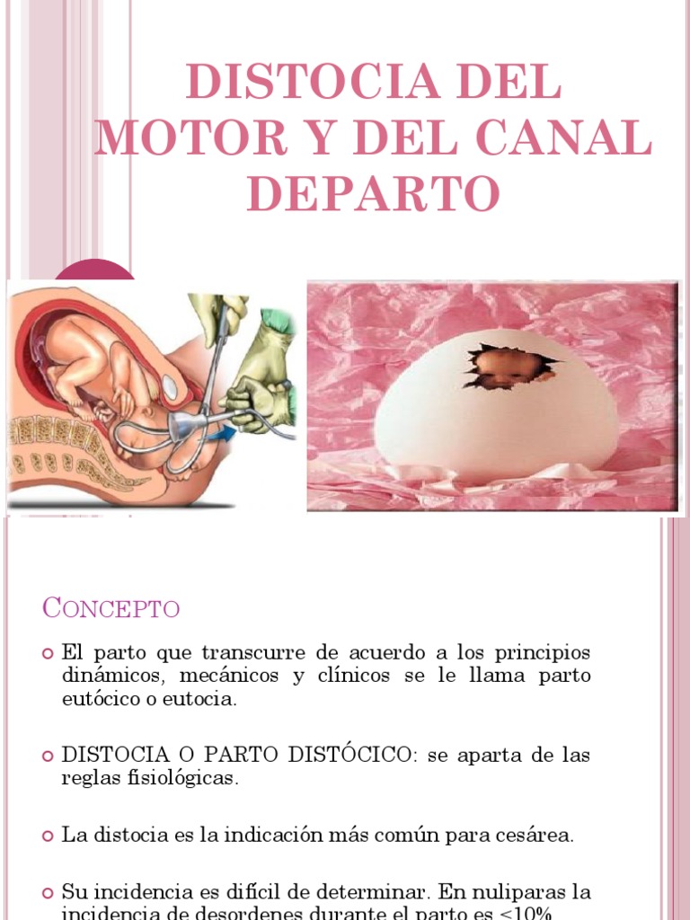 Distocia Del Motor | Parto | Pelvis