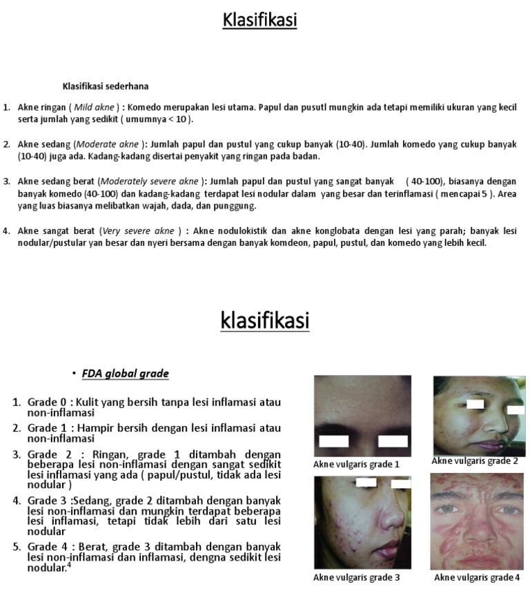 Klasifikasi Acne Vulgaris | PDF