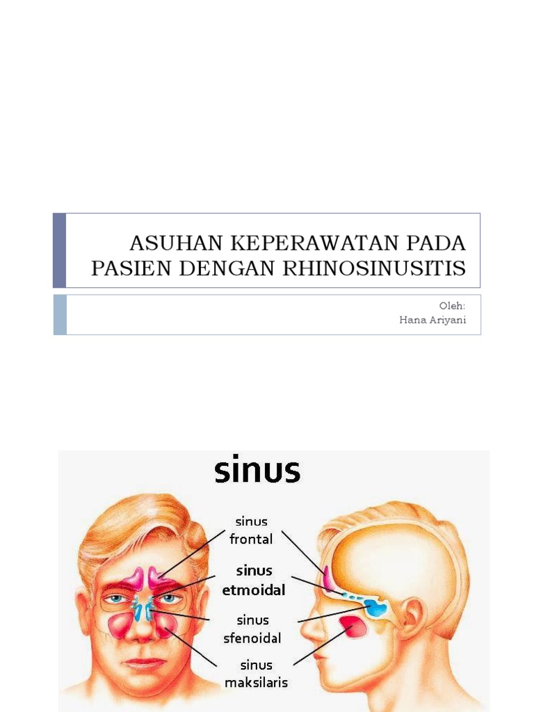 Askep KMB Sinusitis | PDF | Mucus | Immunology