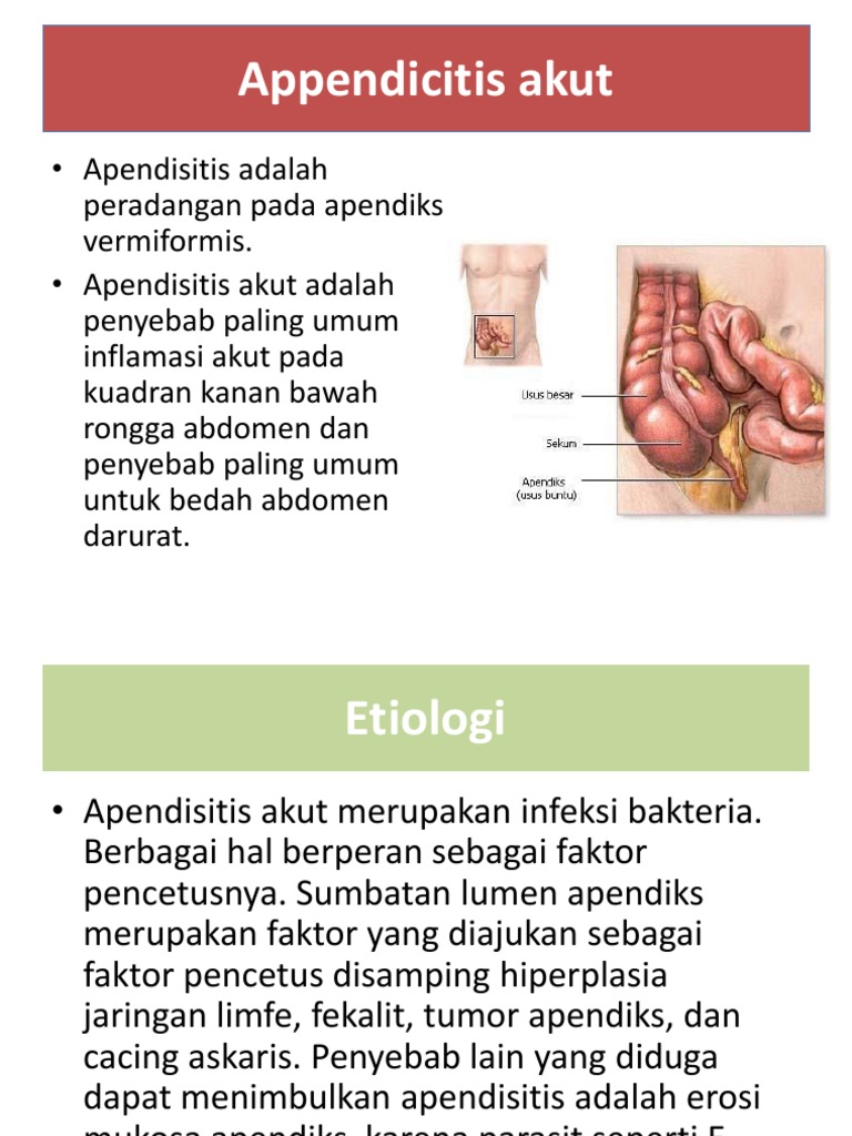 Appendicitis Akut | PDF