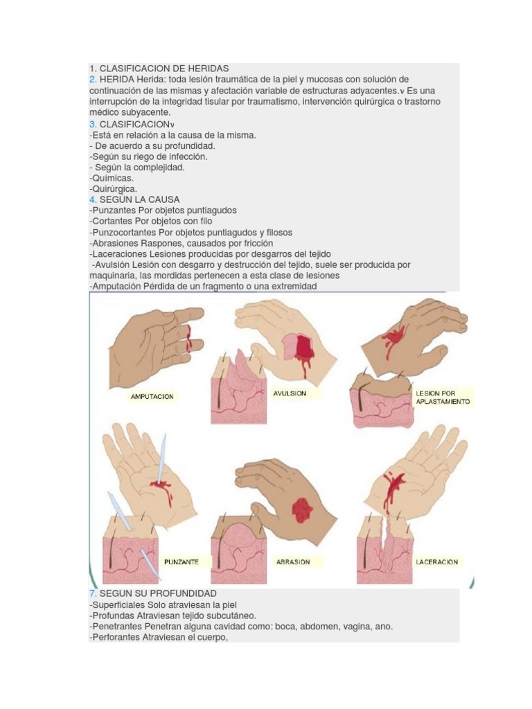 Clasificacion de Las Heridas Explicadas | Herida | Lesión
