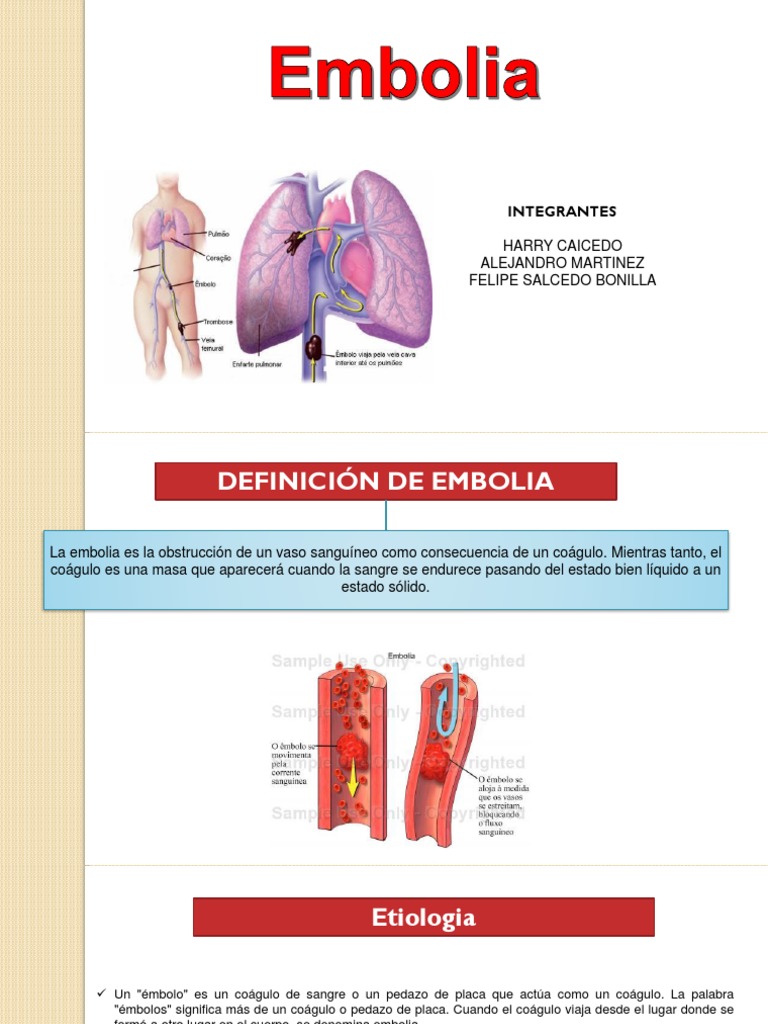 EMBOLIA DIAPOSITIVAS | Embolia | Trombo