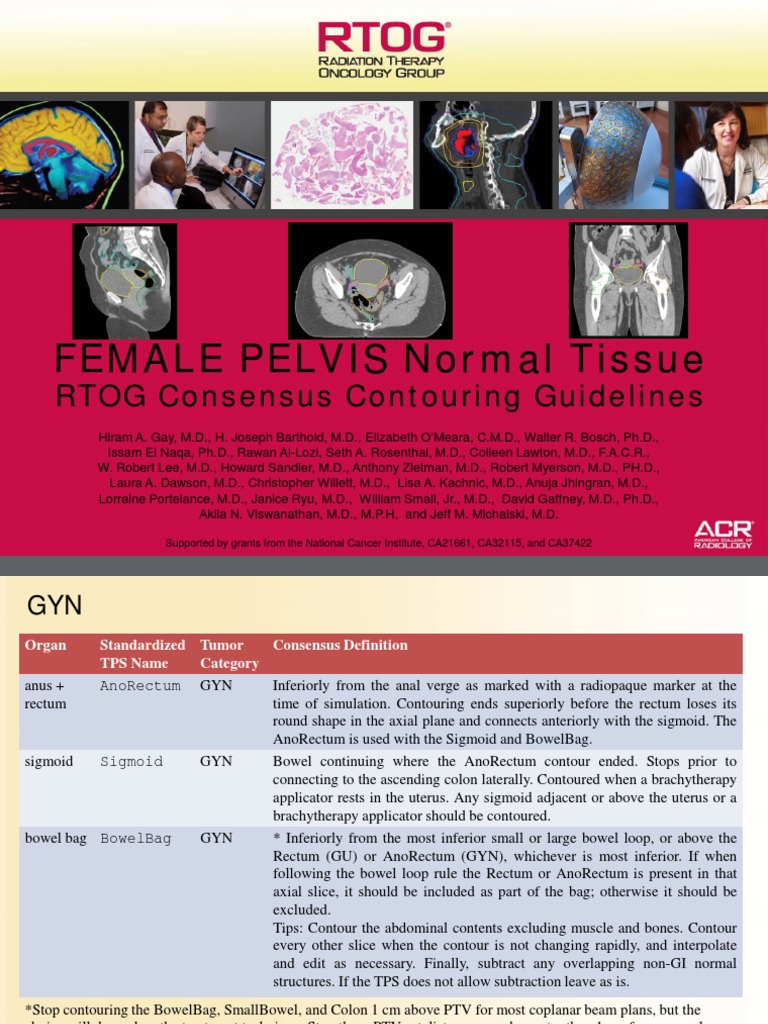Female RTOG Normal Pelvis Atlas PDF | PDF | Gastrointestinal Tract ...