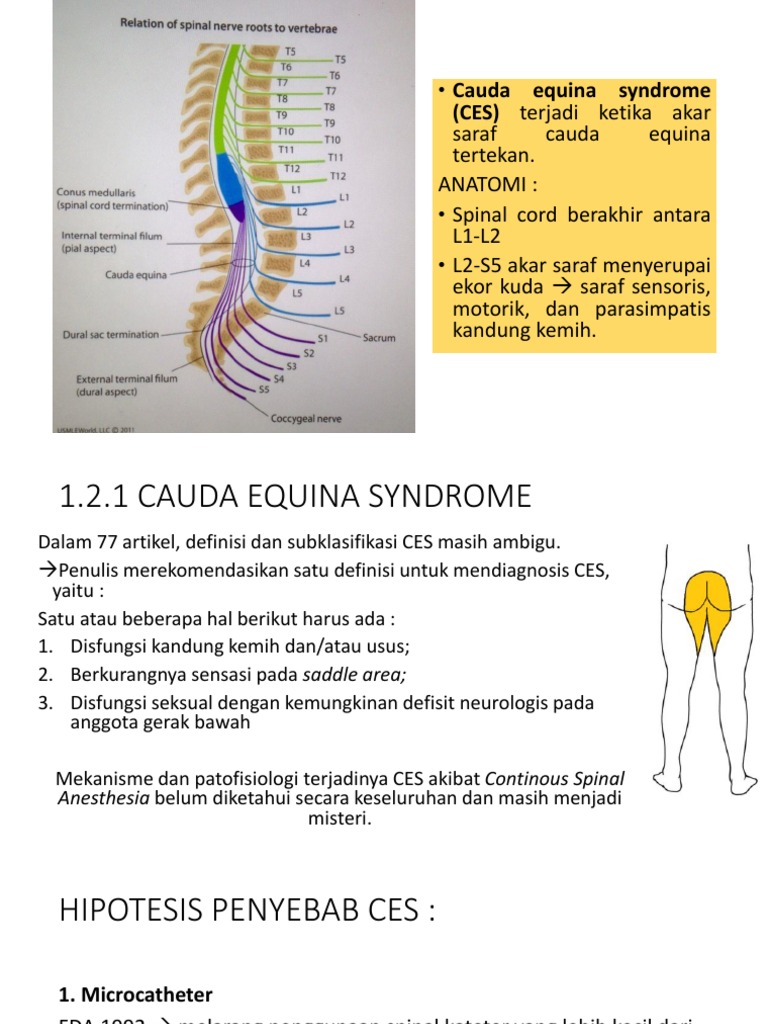 Cauda Equina Syndrom | PDF | Sains & Matematika
