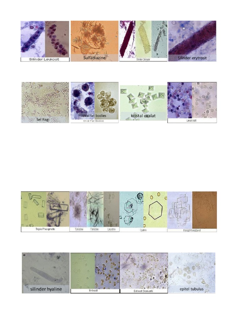 Sedimen Mikroskopis Urine 2 | PDF