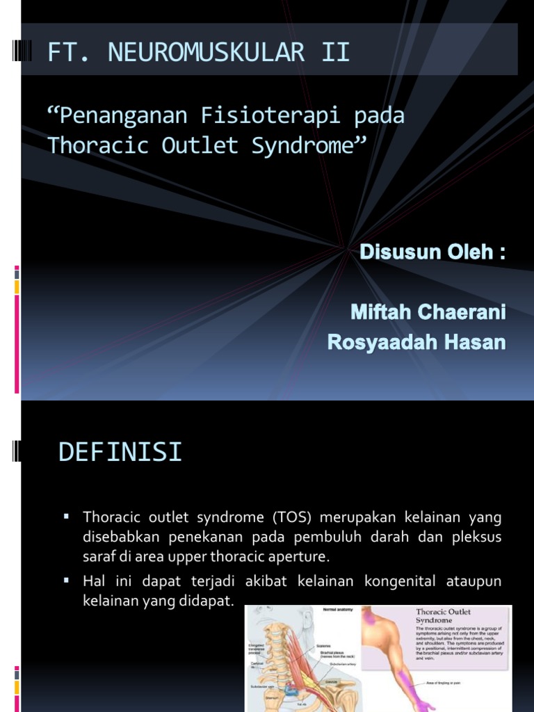 Fisioterapi untuk Thoracic Outlet Syndrome | PDF