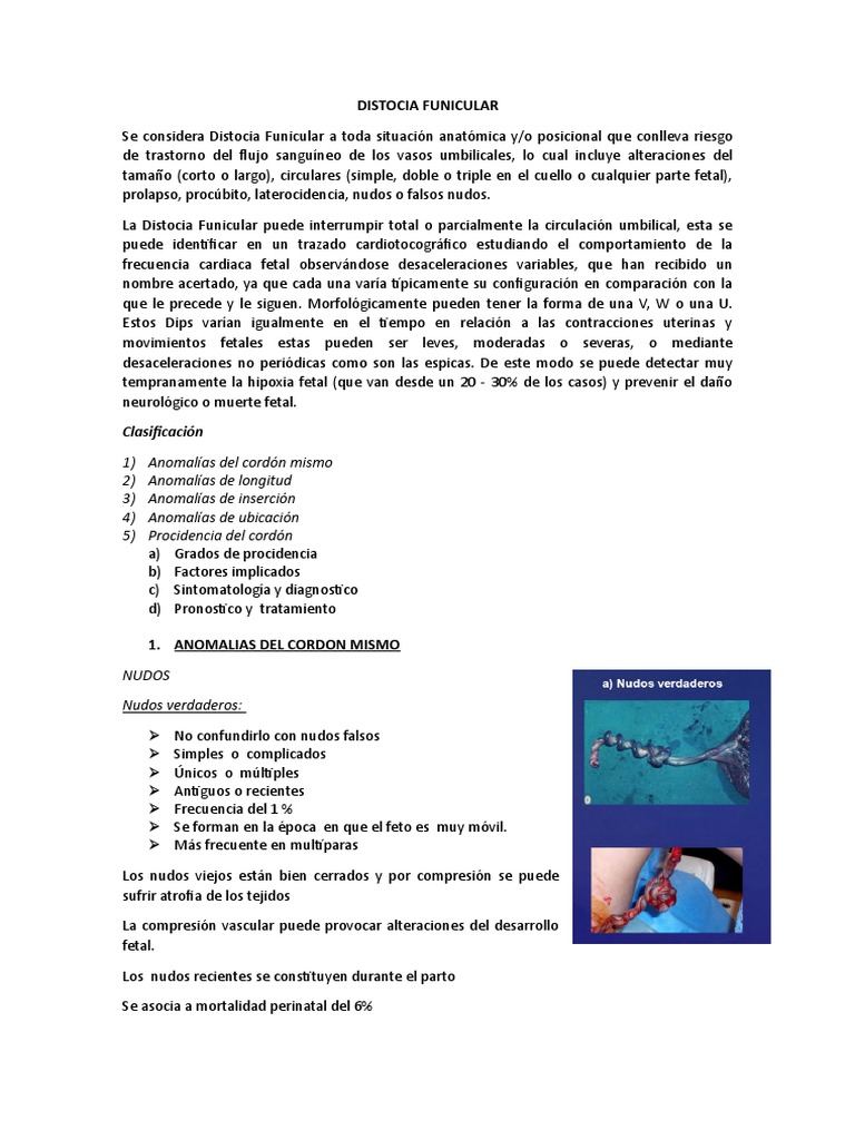 Distocia Funicular: Riesgos y Clasificación | PDF | Parto ...