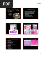 Corneal Dystrophy and Keratoconus Concept Map/ Pathophysiology | PDF ...