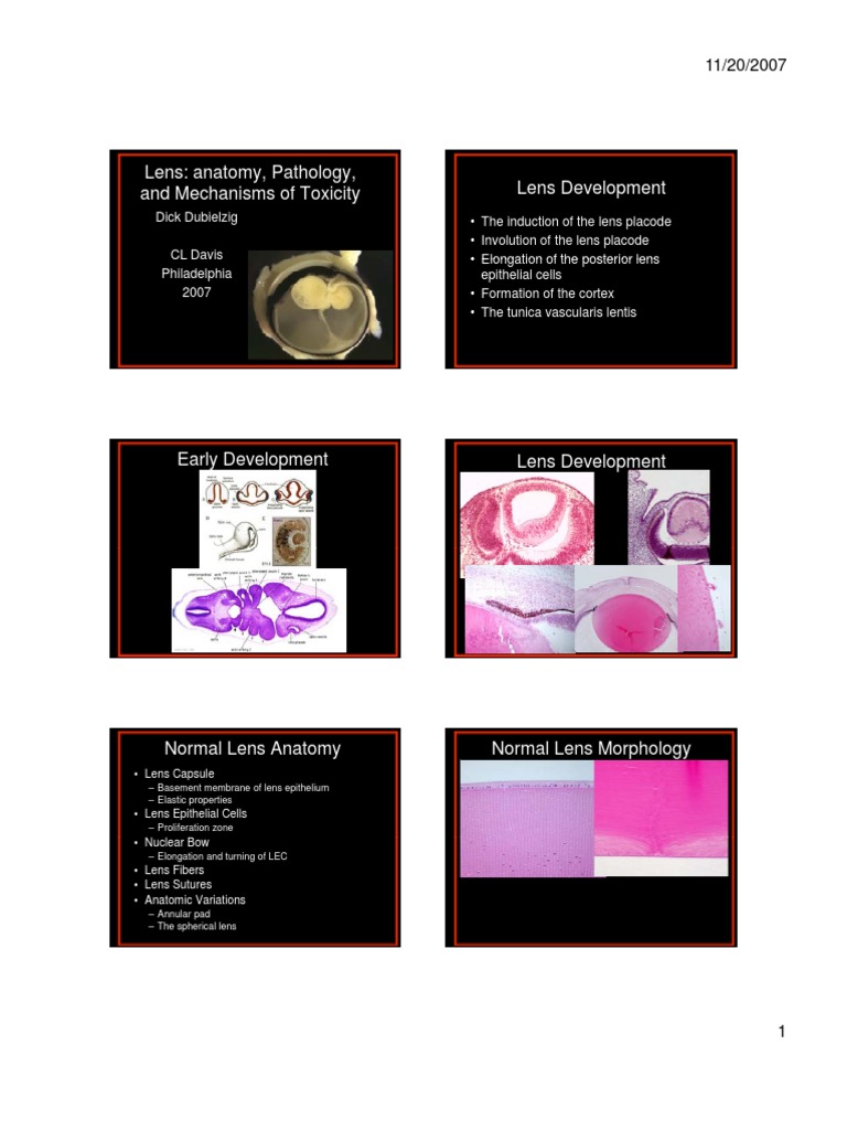 Lens: Anatomy, Pathology, and Mechanisms of Toxicity Lens Development ...