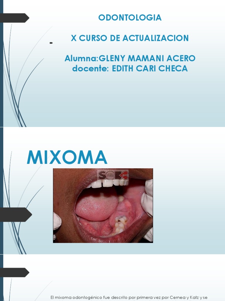 Mixoma Odontogénico: Características y Tratamiento | PDF | Hueso ...