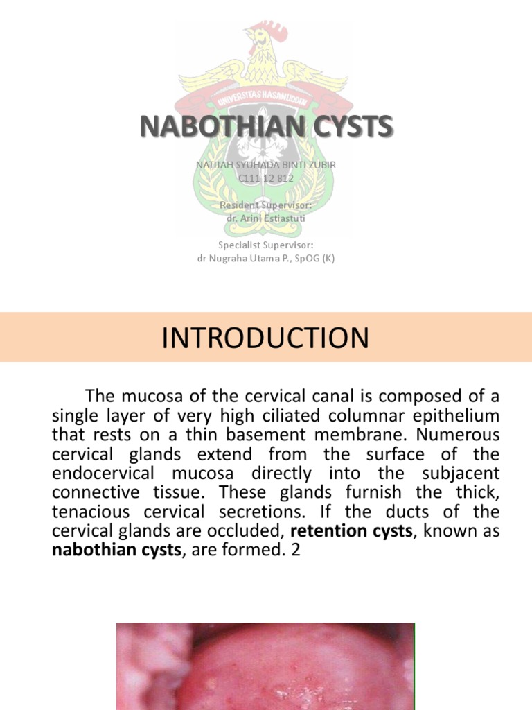 Nabothian Cysts | PDF | Epithelium | Cervical Cancer