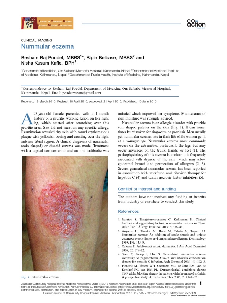 Nummular Eczema | PDF | Dermatitis | Epidemiology