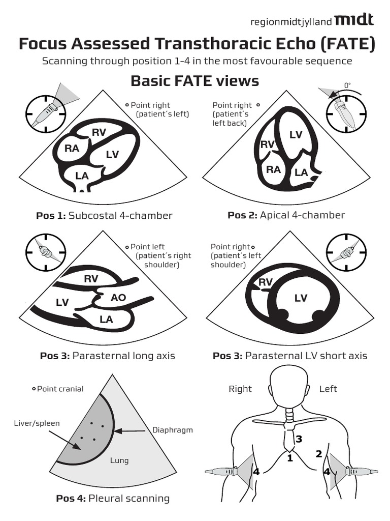 Protocolo FATE (Eco TT) | Ventricle (Heart) | Heart