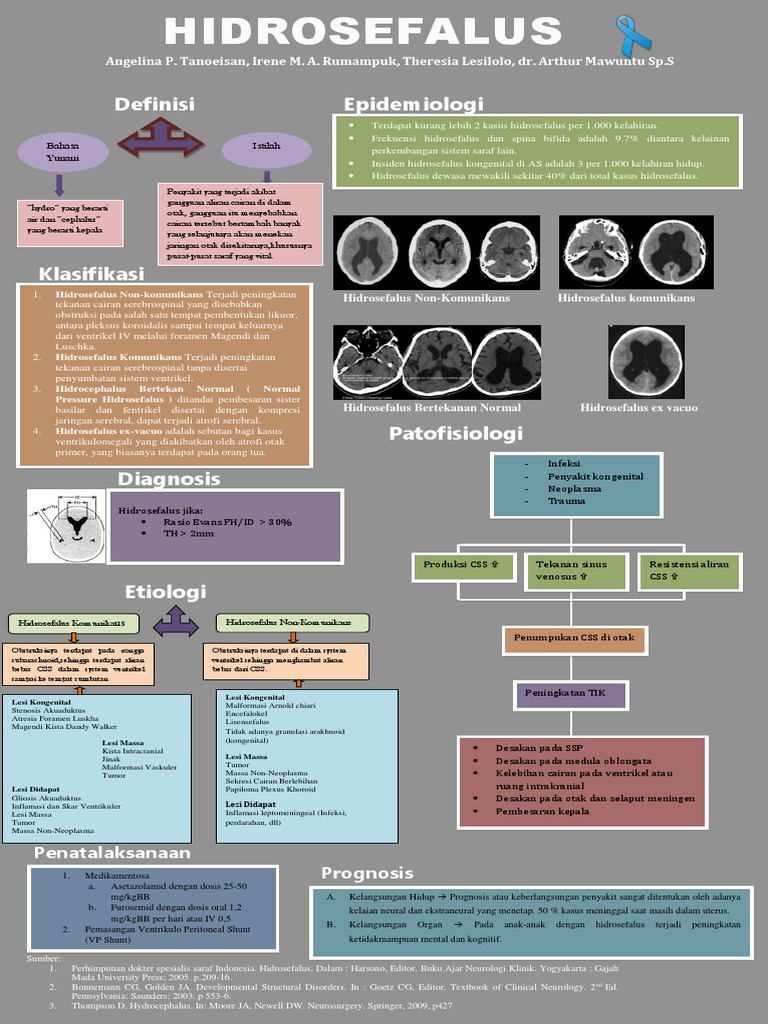 Hidrosefalus Poster | PDF