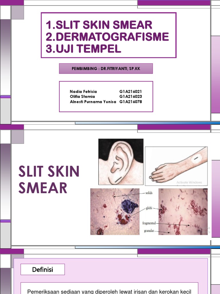 Slit Skin Smear | PDF | Seni | Kesehatan Holistik