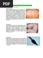 Bula Zina Odt | PDF | Gravidez | Alergia