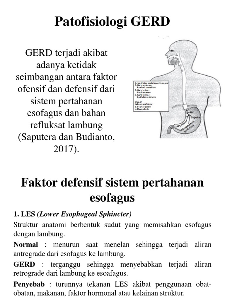 Patofisiologi GERD | PDF
