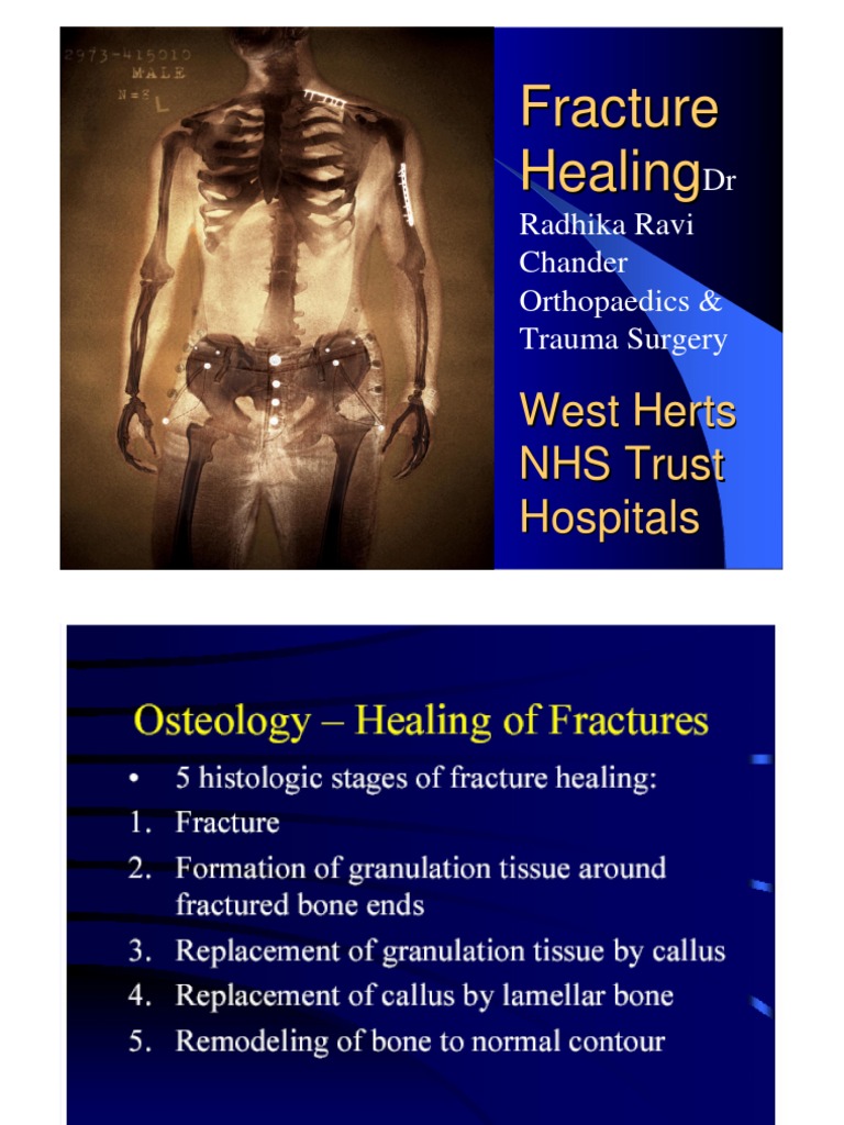 Fracture Healing and Factors Affecting It | PDF | Bone | Osteoporosis