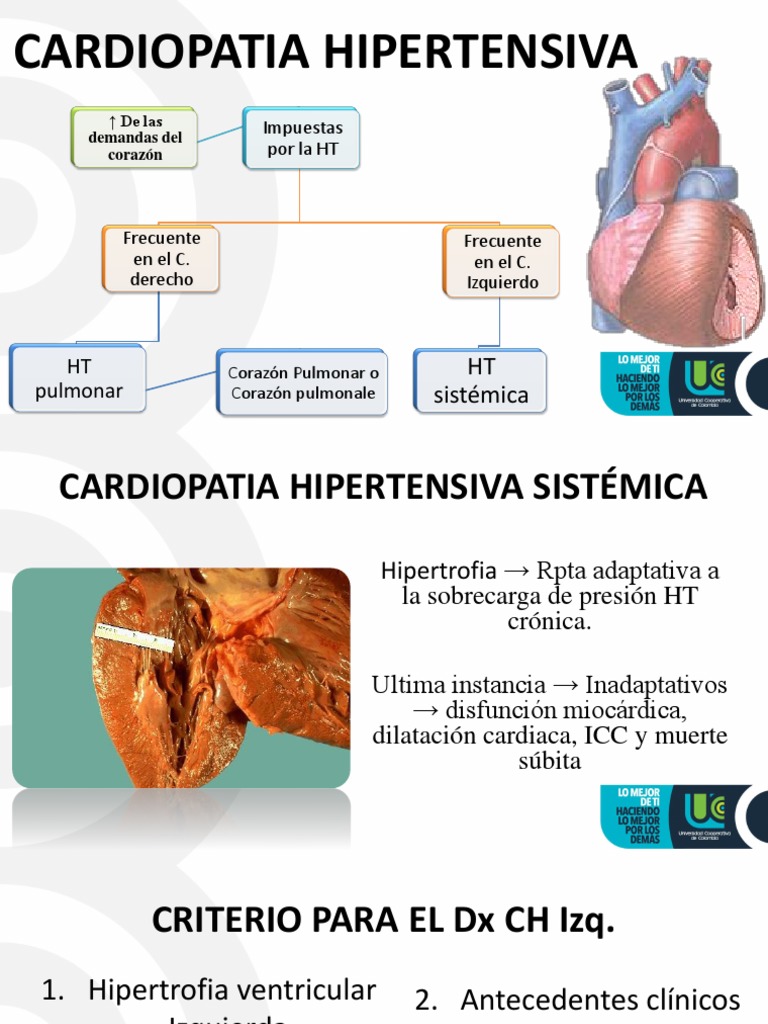 CARDIOPATIA HIPERTENSIVA | Fisiología | Sistema cardiovascular