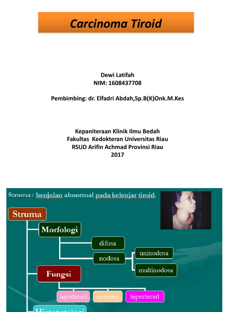 CA Tiroid PPT Dewii | PDF