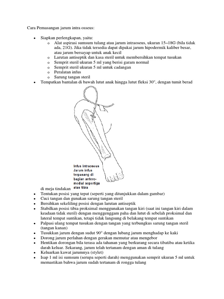 Panduan Pemasangan Infus Intraosseous | PDF | Pengembangan Diri