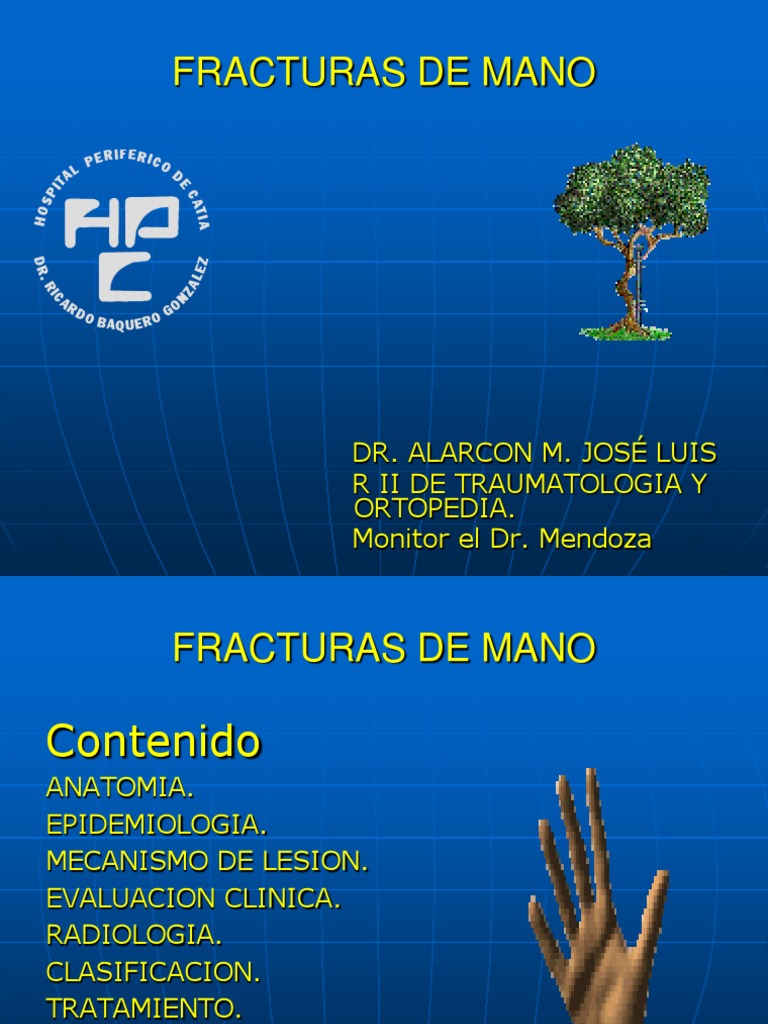 Clasificación y Tratamiento de Fracturas de Mano | PDF | Mano | Sistema ...